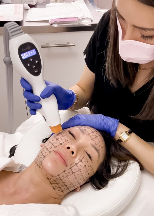 Themage Before + After: Skin Tightening Treatment | YesMissy
