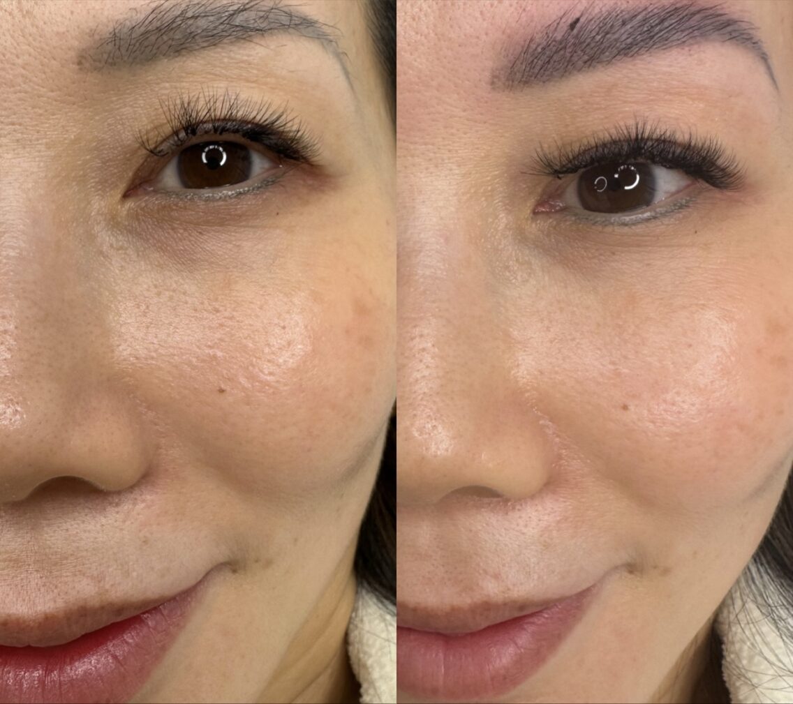 The Best LED Light Mask: A Deep Dive into the JOVS 4D Laser Light ...